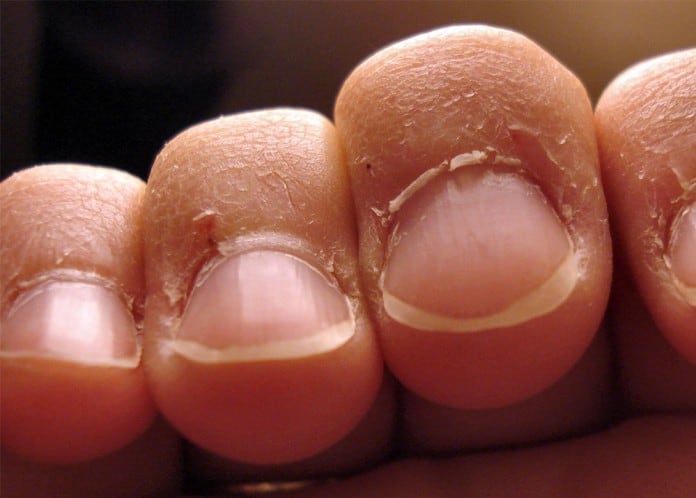 Do Cuticles Grow Back? | Polish and Pearls