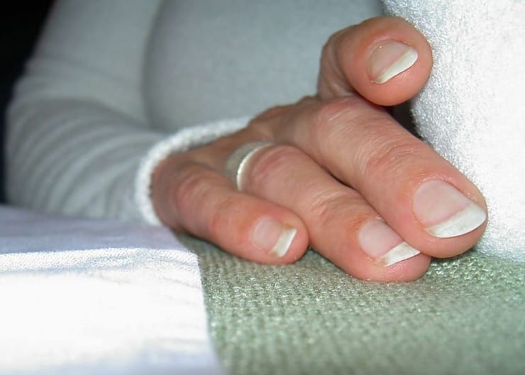 Understanding and Treating Common Fingernail Abnormalities | Polish and ...