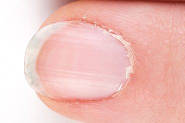 What Happens if You Don't Push Your Cuticles Back | Polish and Pearls